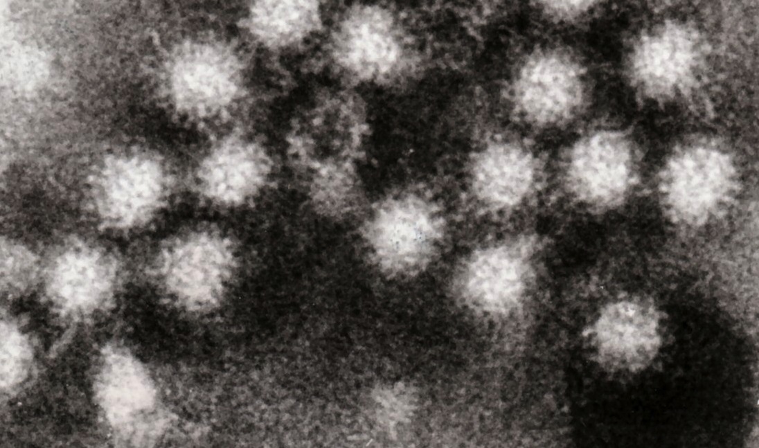 eScienceCommons: Norovirus stays infective for months in water
