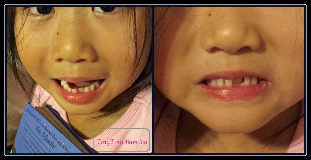 TingTingMamMa: JJ's Loose Teeth & Teeth Pouch