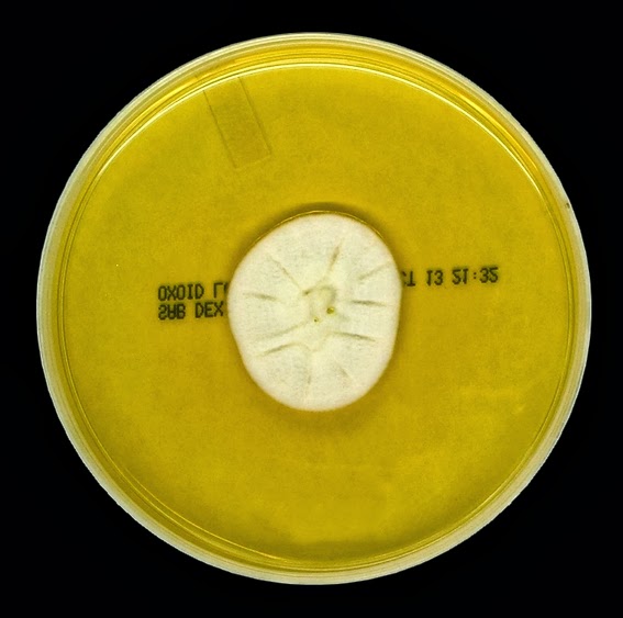 Fun With Microbiology (What's Buggin' You?): Trichophyton terrestre
