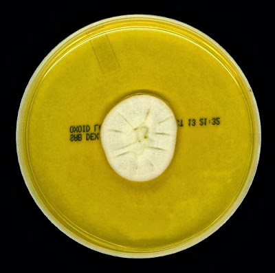 Fun With Microbiology (What's Buggin' You?): Trichophyton terrestre