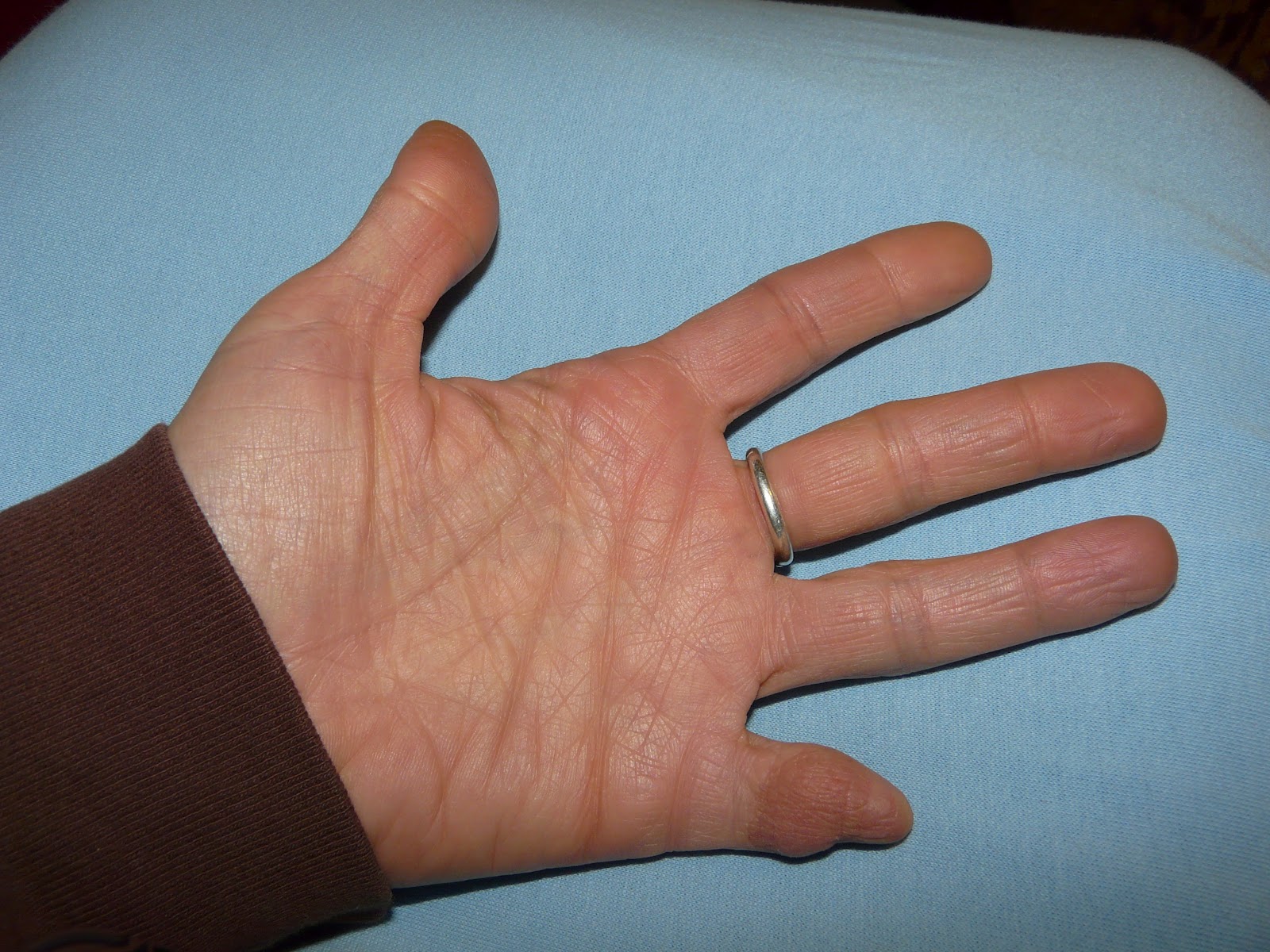 The "Secret" is Gratitude: Slide Safety - Loosing a Finger - Life ...