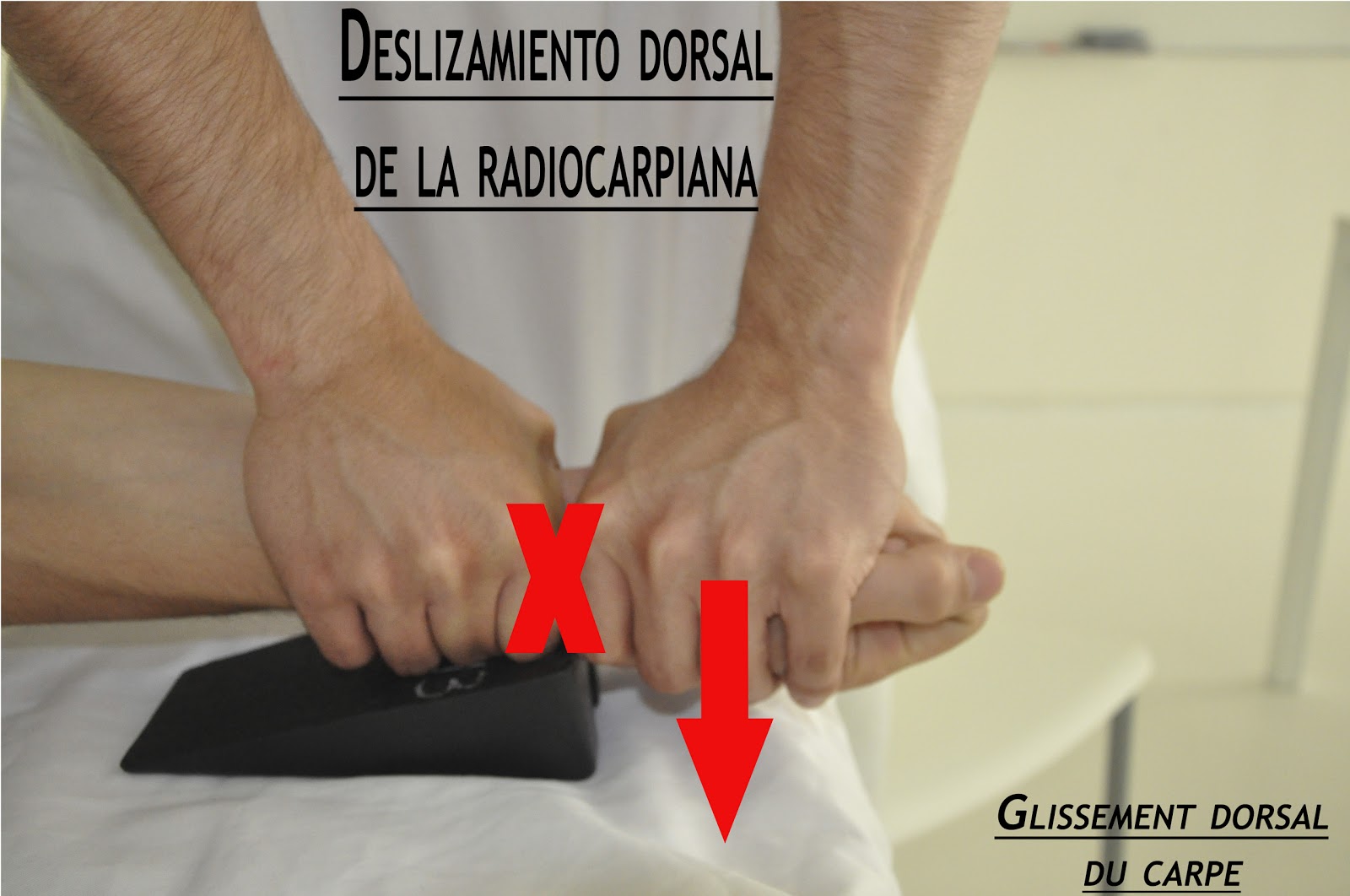 Érase una vez..tu radiocarpiana y sus huesitos: La radiocarpiana...eso ...