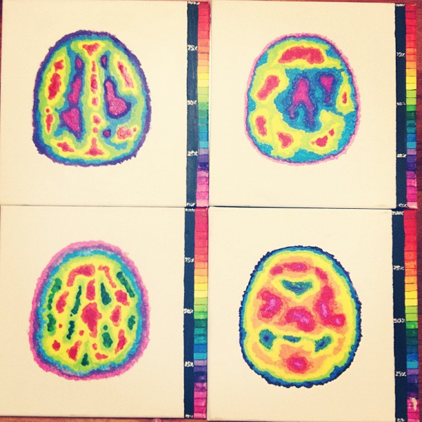 Twelve: Brain scans of mental illness