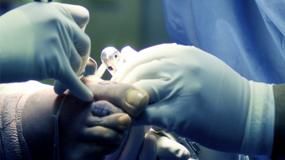 Reconstructive Foot Surgery - Nashville Podiatrists: The Nashville Foot ...