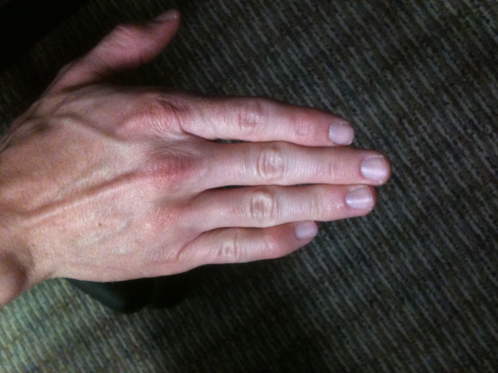 The Holistic Athlete: Check Your Finger Lengths