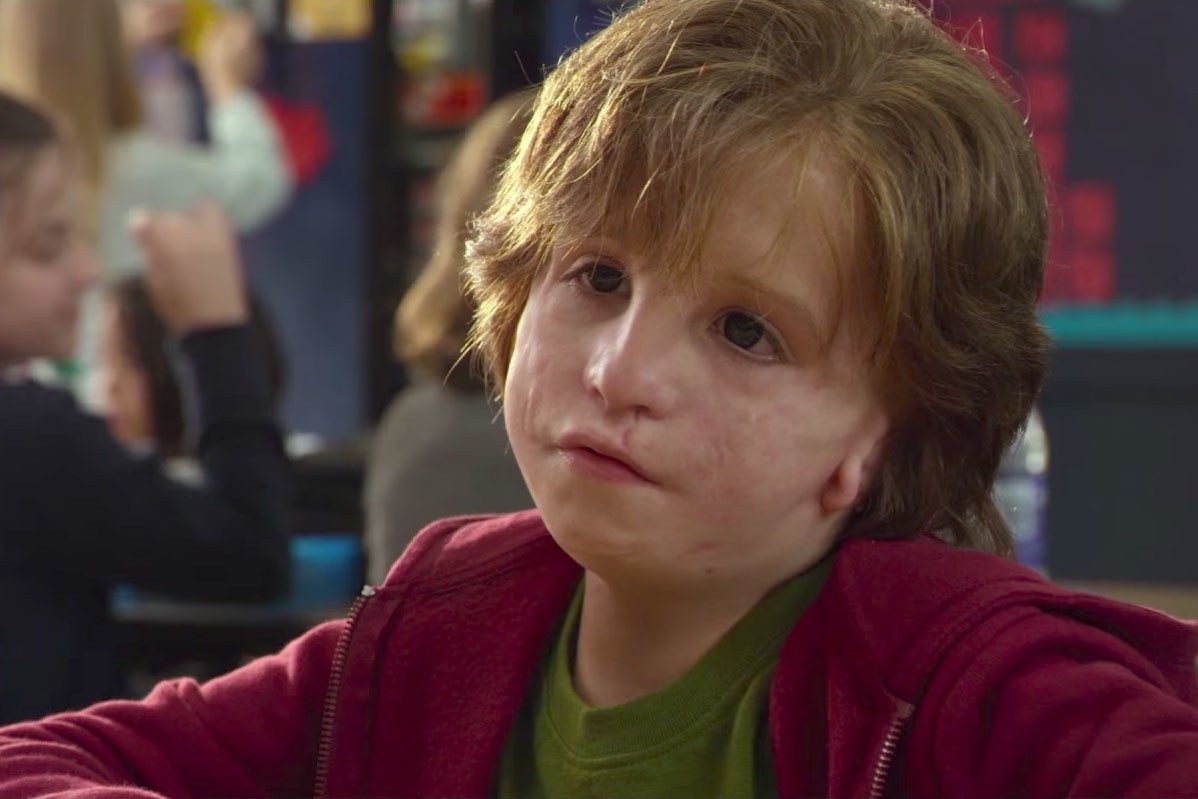 Sala-Escura - Cinema por Chico Izidro: "Extraordinário" (Wonder)