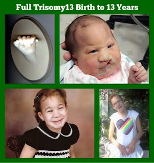 Trisomy 13 Life with Natalia ~ Transformed by Love: June 2009