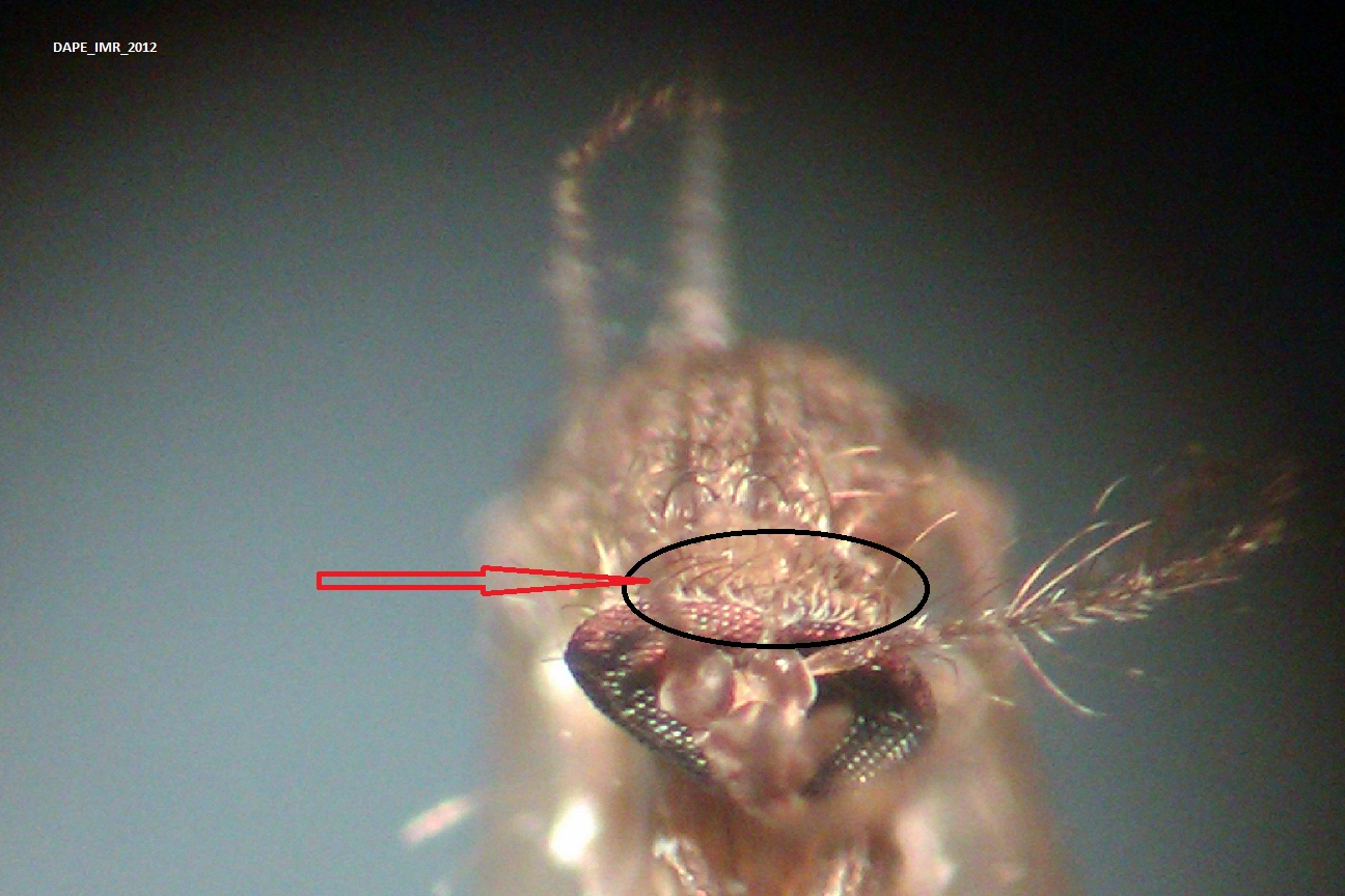 MEDICAL ENTOMOLOGY: Identification of Culex sp. (Adult)