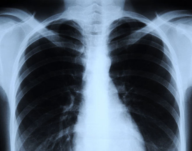 X-Rays' Machines Damage DNA - Biotech News
