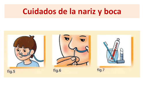 Blog de Pequefarma sobre Nutrición Infantil y Salud: Cuidados de una sonda Blog de Pequefarma sobre Nutrición Infantil y Salud: Cuidados de una sonda