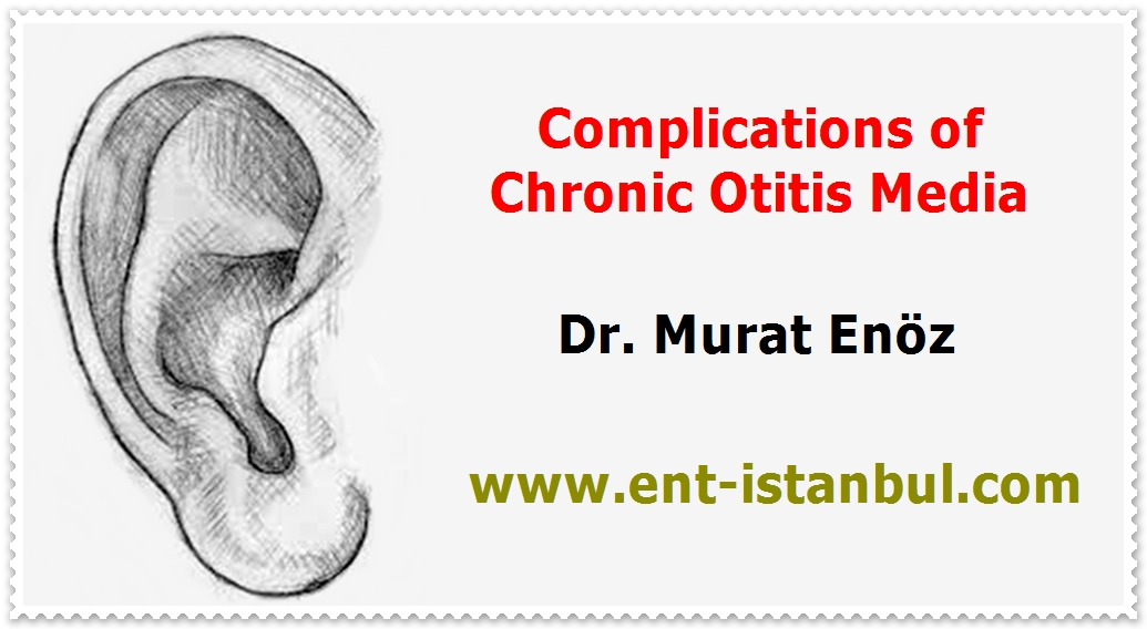 Chronic Otitis Media - Definition, Symptoms, Complications and Treatment
