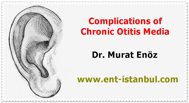 Chronic Otitis Media - Definition, Symptoms, Complications and Treatment