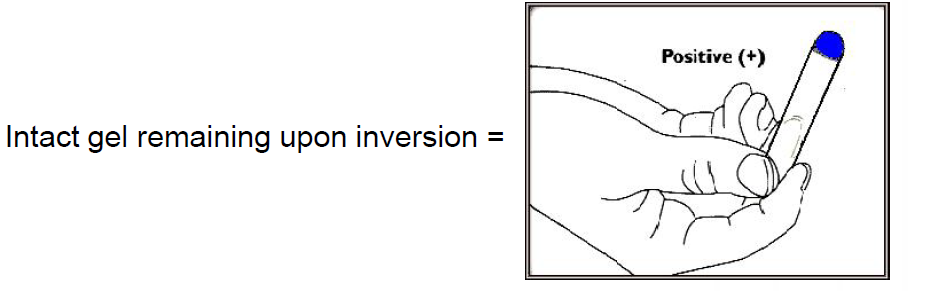 PHARMACEUTICAL MICROBIOLOGY: Gel- Clot Test