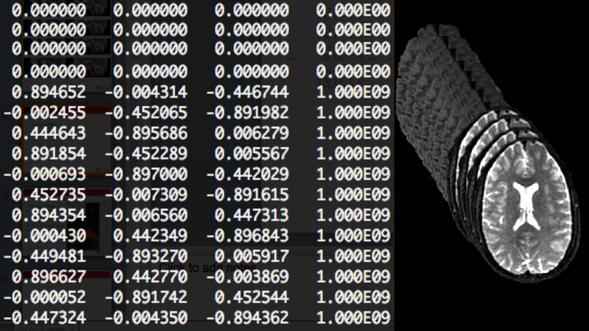 DTI Tutorial 1 - From Scanner to Tensor | Diffusion Imaging ...