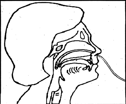 Ilmu Pengetahuan: PROSEDUR PEMENUHAN KEBUTUHAN OKSIGEN