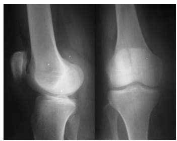 Patología Traumatologíca IVSS Lara: TEMA 2