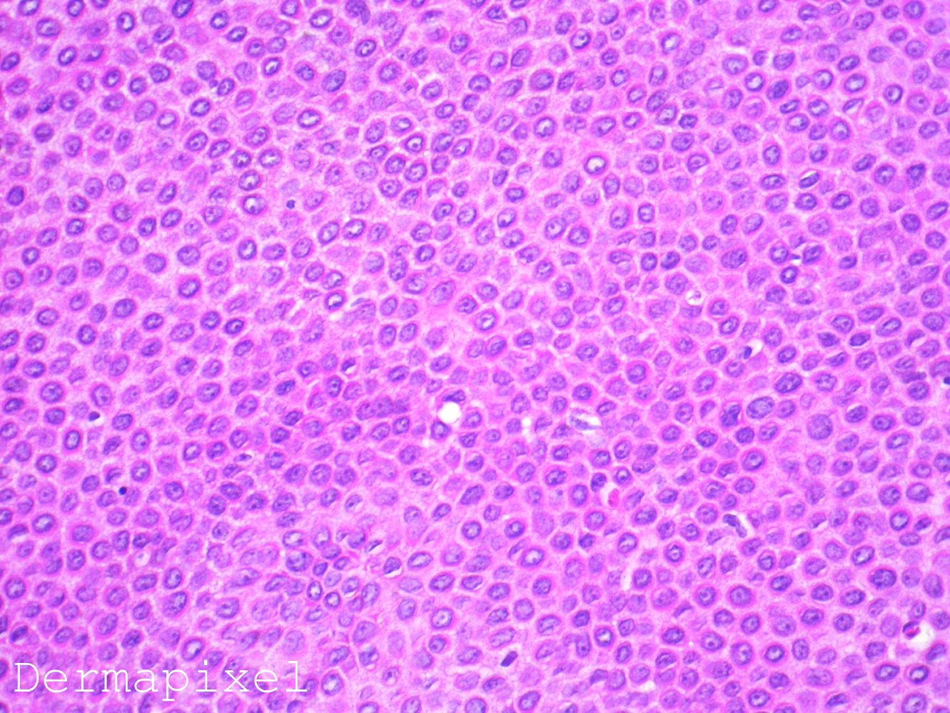 Dermapixel: junio 2013