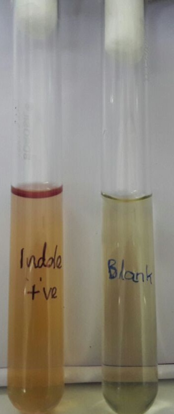 SENTHIL PRABHU SIVASAMY: Indole Test