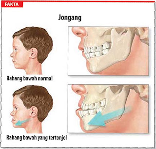 nurel ainy: Aduhai la gigi...