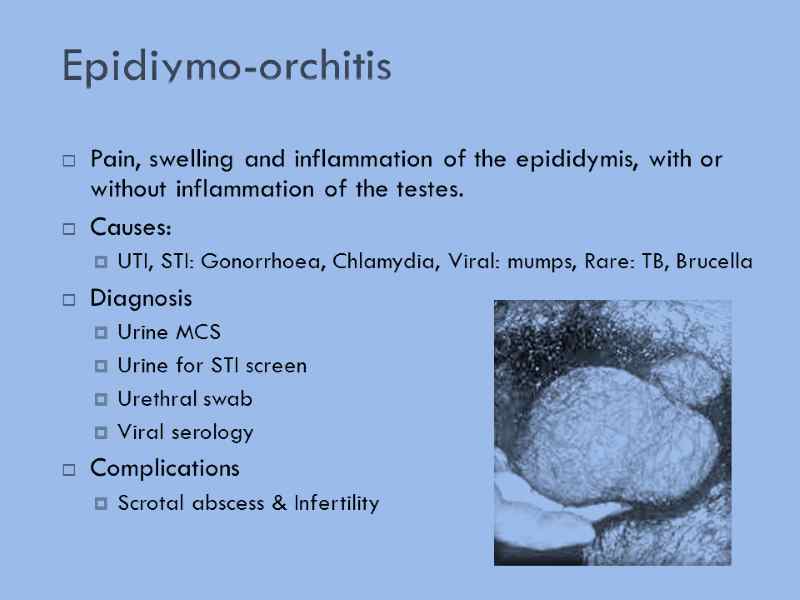 Epididymitis Symptoms: Epididymitis - Scrotal Pain