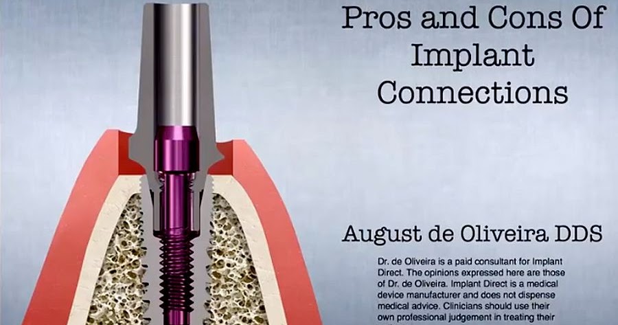 WEBINAR: The Evolution of Implant Connections - Dr. August de Oliveira ...