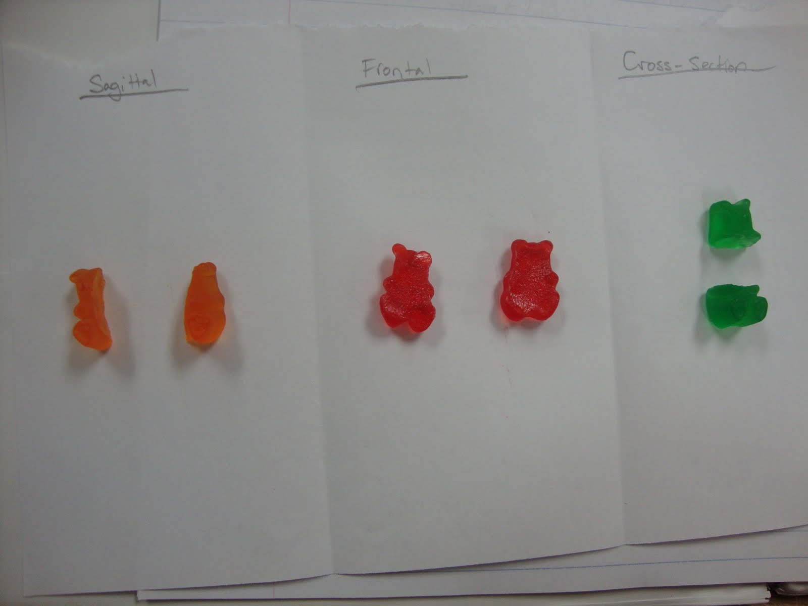 Anatomy&Physiology212: Body Planes and Sections