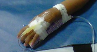 DISTRIBUTOR SPALK: Cara Penggunaan