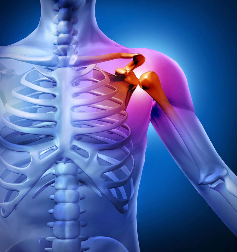 ISIC Online: How do you overcome shoulder problems