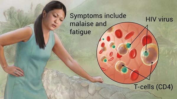 Symptoms and stages of HIV infection