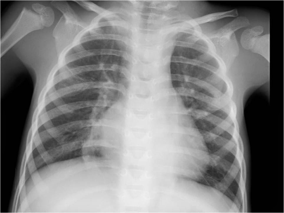 RADIOLOGY IMAGE SPOTTERS: June 2014