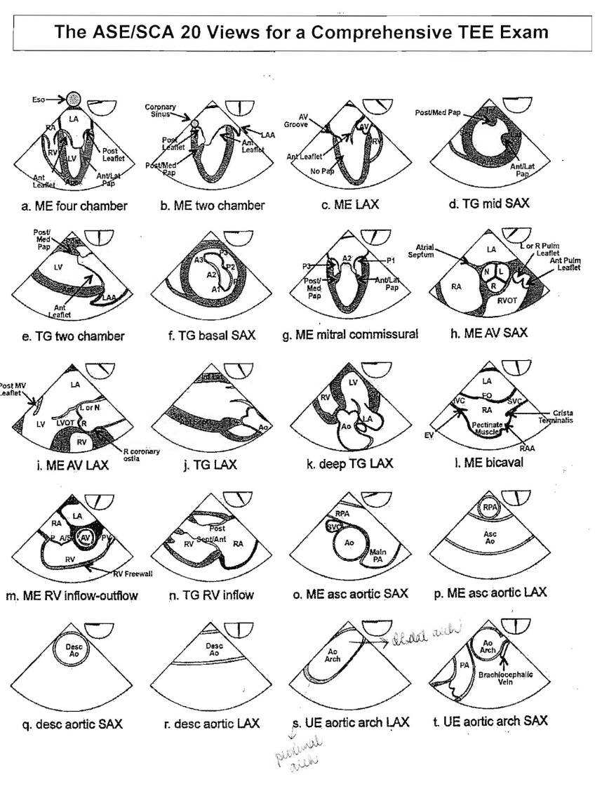 阿倫的CV歲月筆記: [ECHO] TEE: 20 standard view