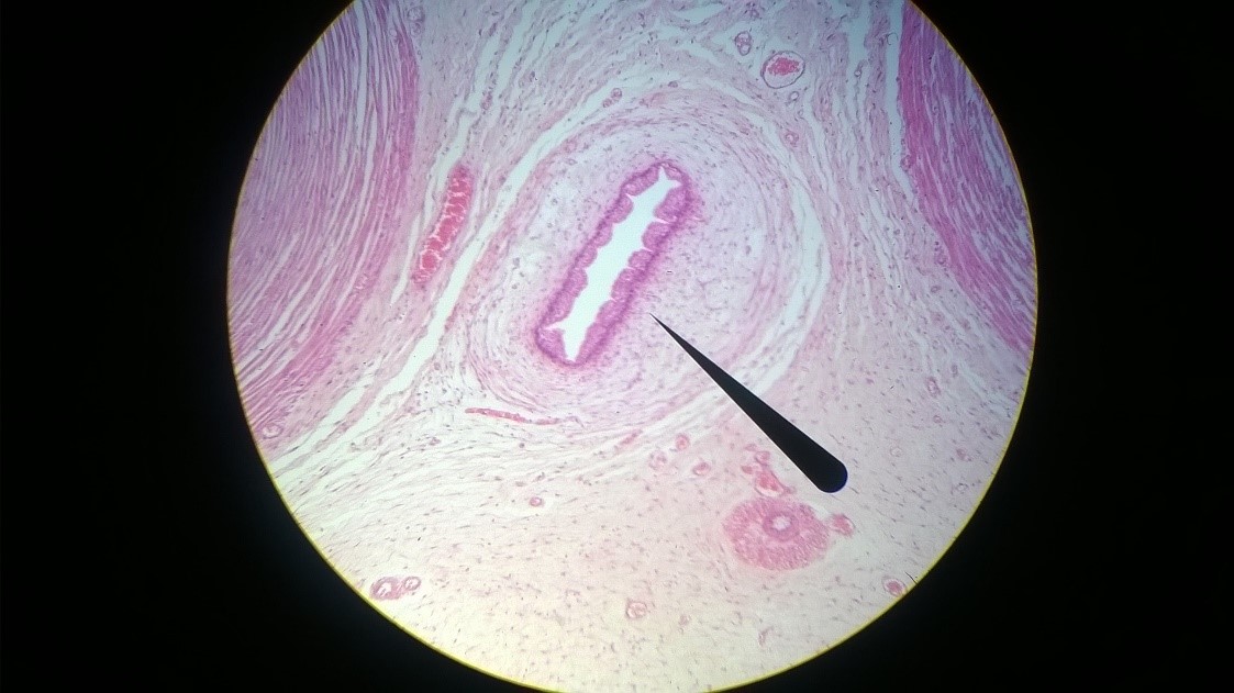 Histología: Tejido Conjuntivo Laxo