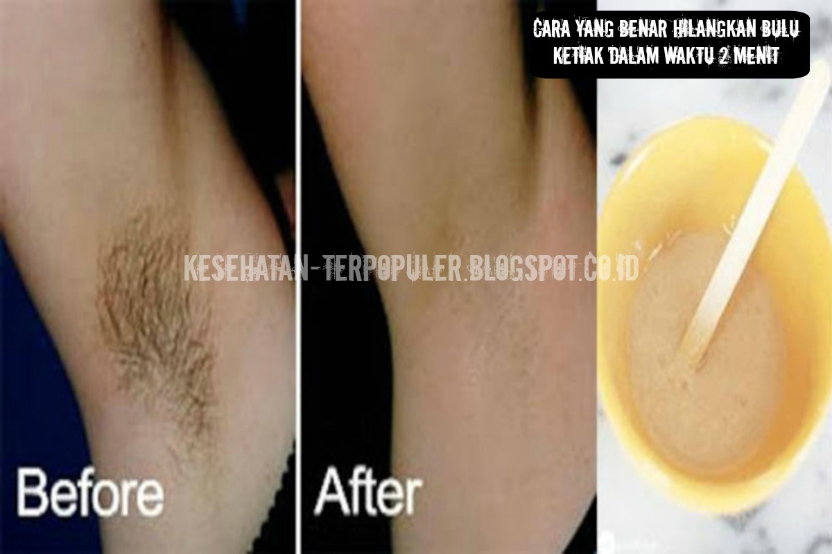 Cara yang Benar Hilangkan Bulu Ketiak Dalam Waktu 2 Menit | KESEHATAN TERBARU