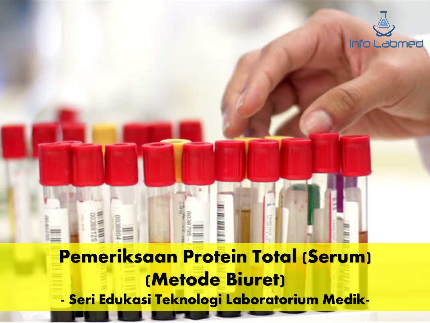 Pemeriksaan Protein Total (Serum) (Metode Biuret)