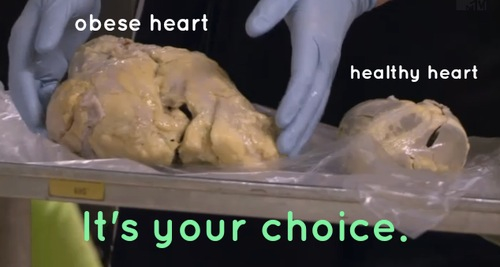 A new beginning- My journey to avoid the knife: Effects of Obesity