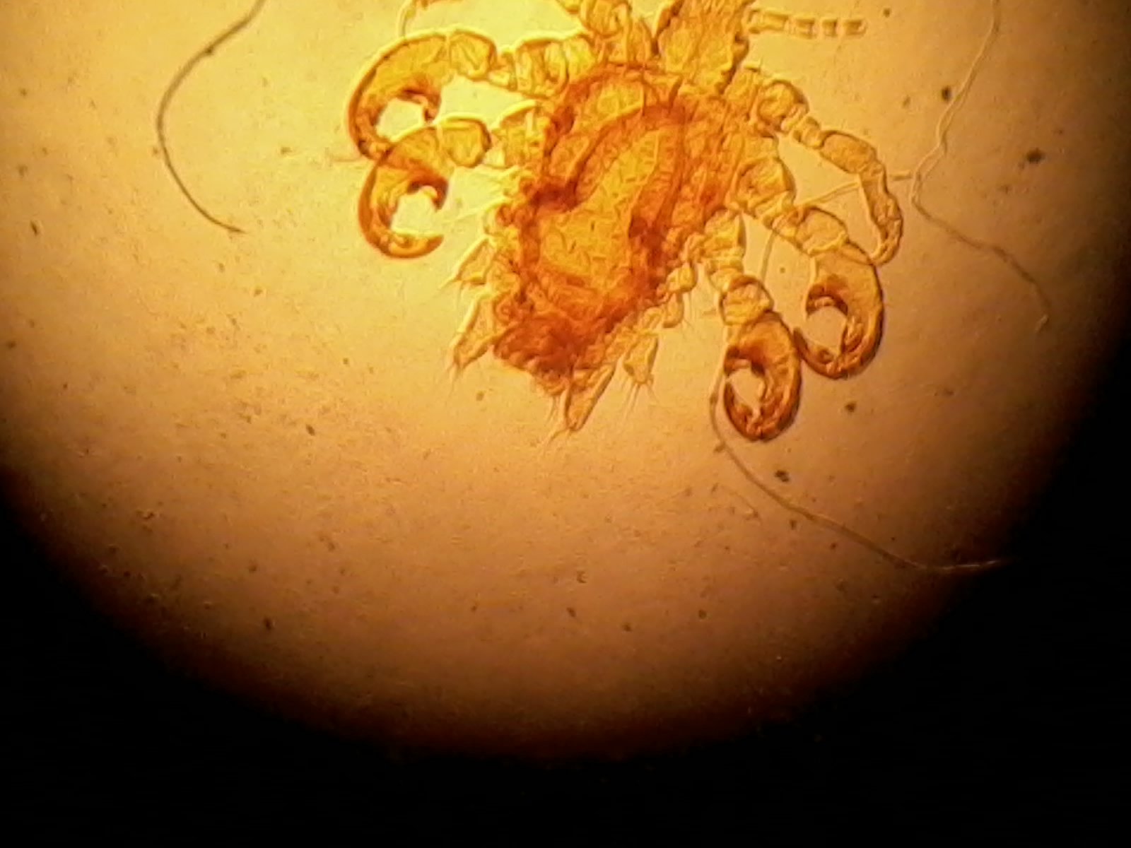 KLIMAKS: KUTU & PINJAL