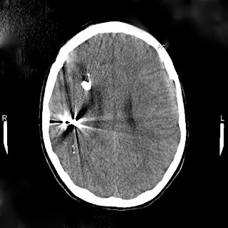 ~♥~VisibleAngels~♥~: CT Scan pics and other new updates...