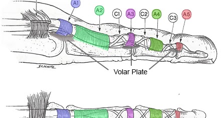 Rauf Yousaf | Blogspot: Flexor Tendon Pulleys of the Fingers