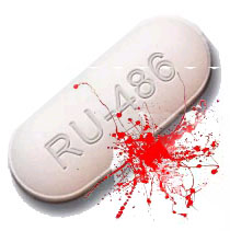 Informacion acerca de los Abortos: Clases de Abortos