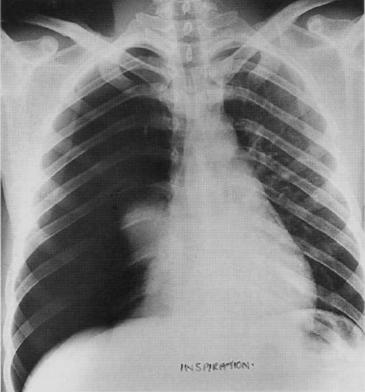 imaging of rontgen: BELAJAR BACA FOTO THORAX