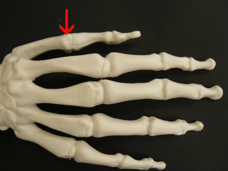 El Cuerpo Humano: El metacarpo