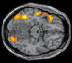 PSICOLOGÍA: Imágenes reales de cerebros