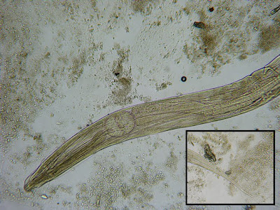Fun With Microbiology (What's Buggin' You?): Enterobius vermicularis ...