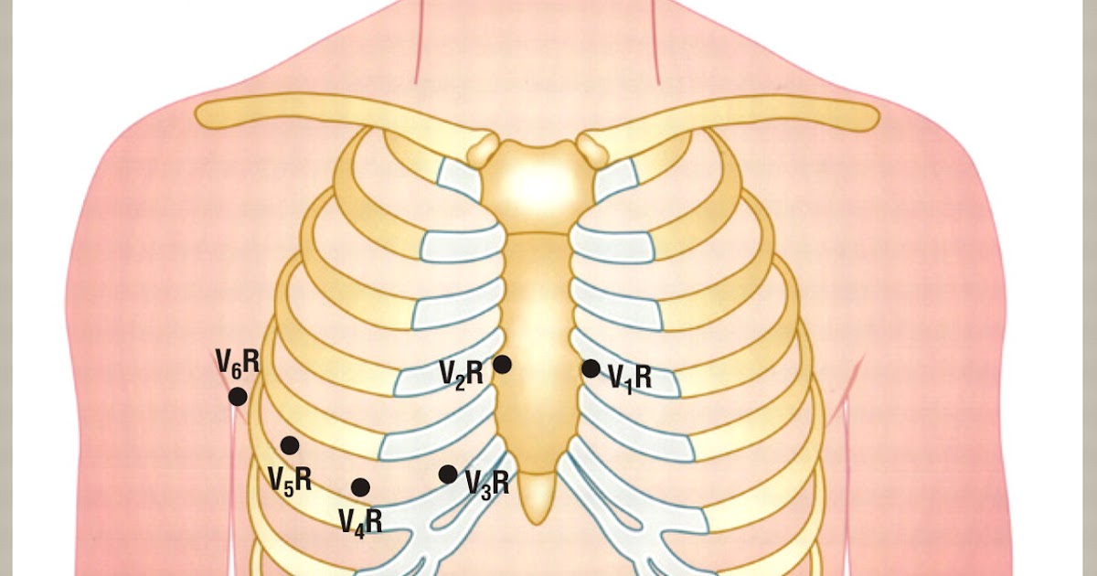 Lead EKG Prekordial Kanan | INA - ECG