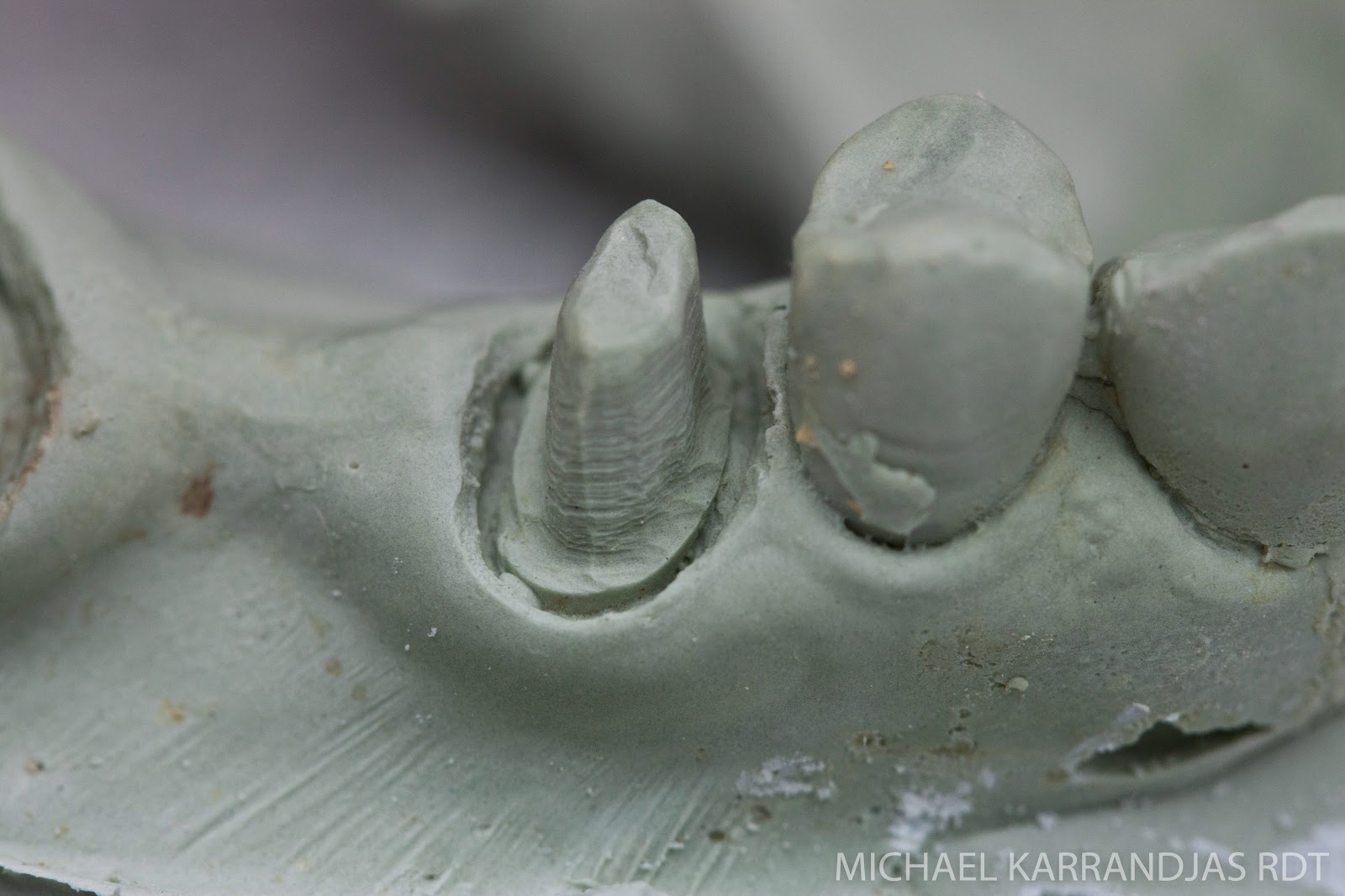 Dental Lab Model Fabrication | Making Noise And Drinking Beer