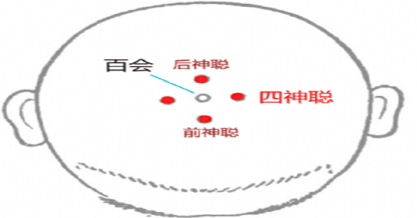 四神聰穴位置 | 四神聰穴痛 - 穴道按摩與穴位引導經絡功效圖解 - 穴道經絡引導