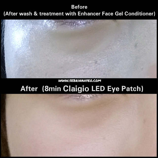 CLAIGIO LED Magic Eye Patch Malaysia Review - Sebrinah Yeo