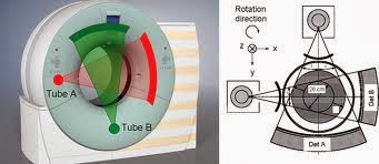 ZONA RADIOLOGY: Perkembangan CT Scan (Generasi I - Sekarang)