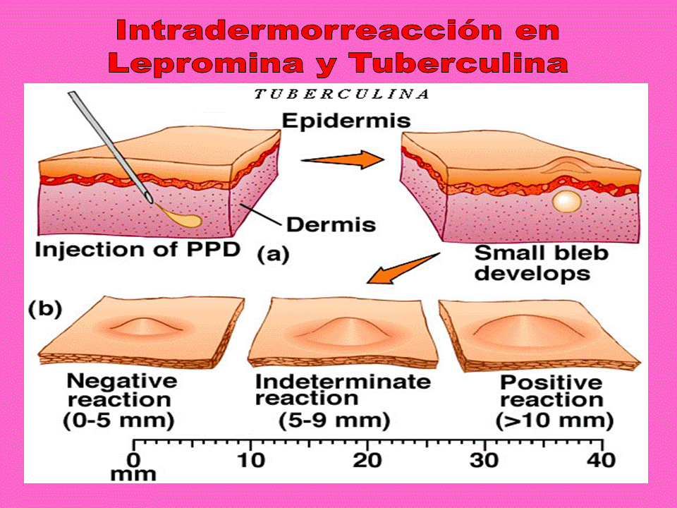 L810: MICOBACTERIAS