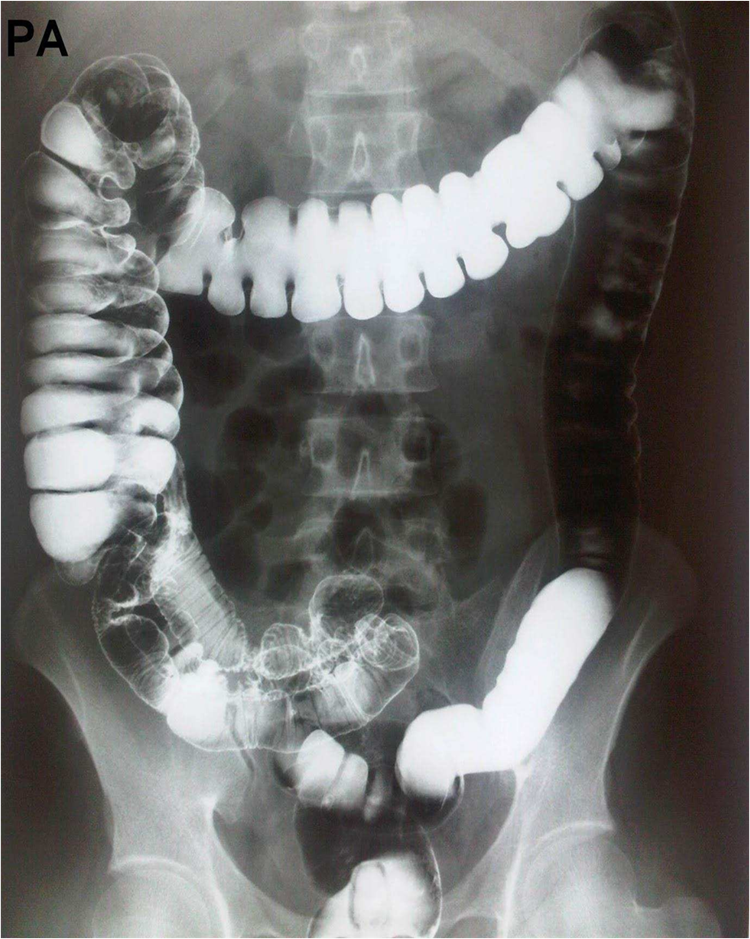LABORATORIO DE IMÁGENES: Clase 6, 7 y 8 - ABDOMEN Y RETROPERITONEO